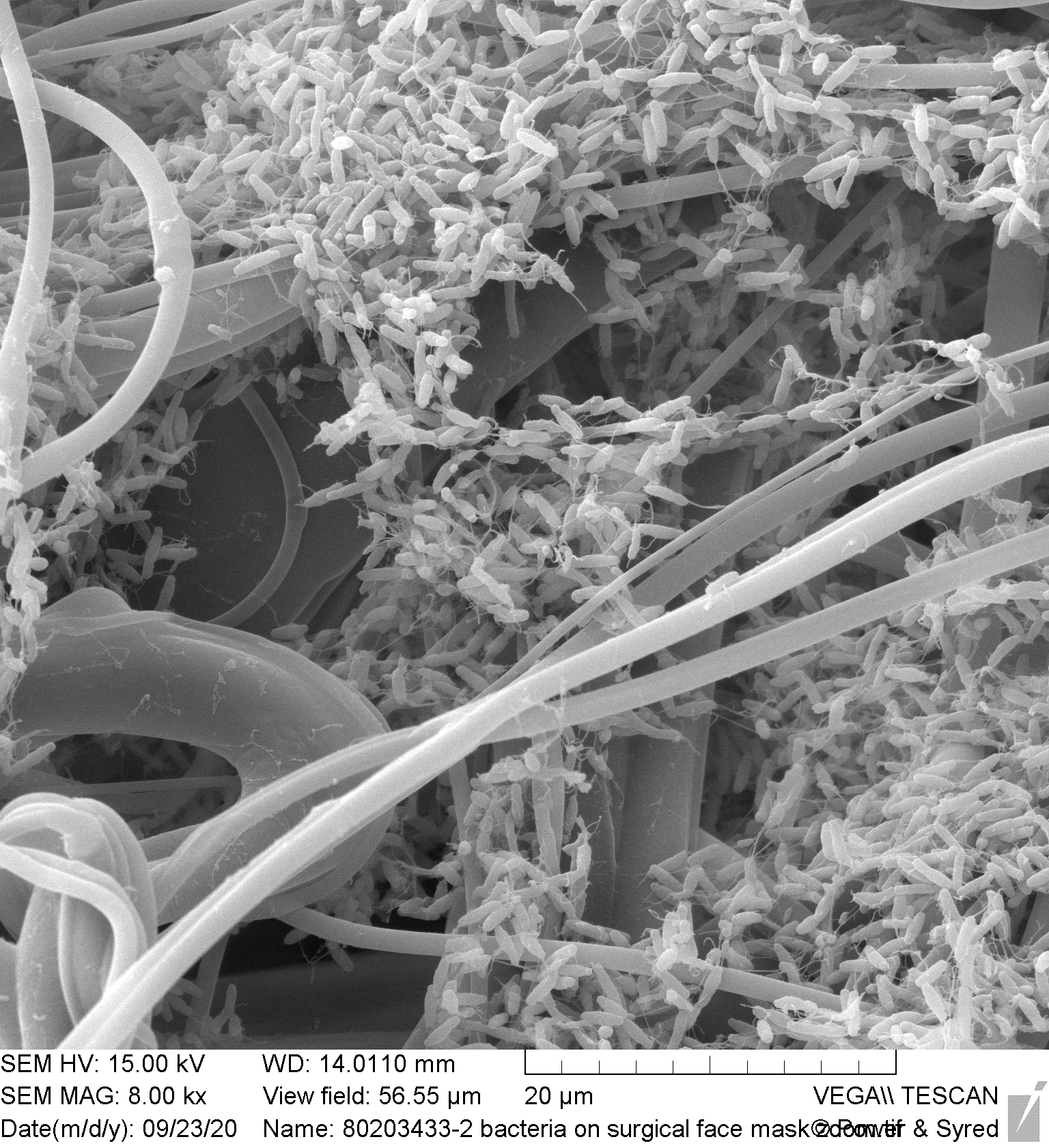 Micrograph of Pathogens on a Mask - Magnesium and Health